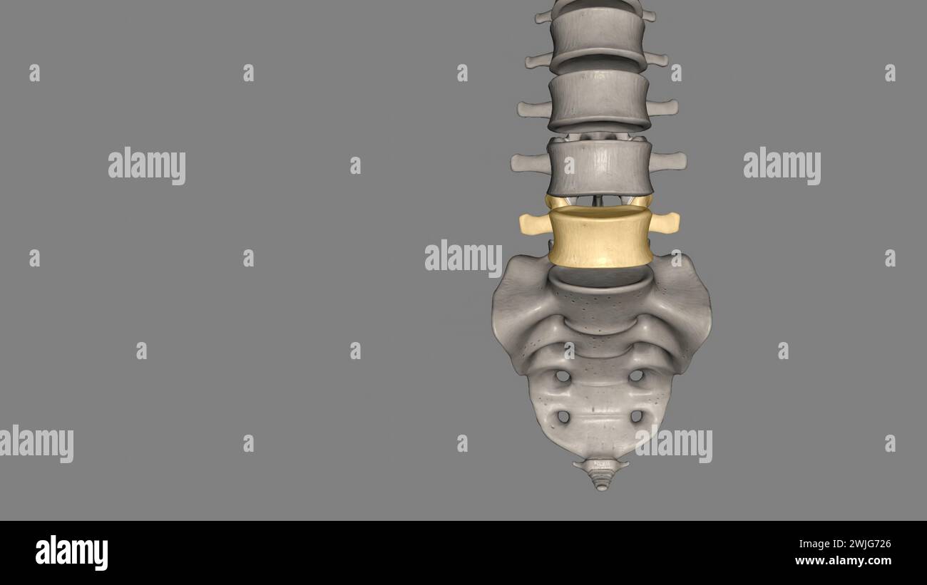 The L4 and L5 are the lowest vertebrae, or spinal bones, in the lumbar ...