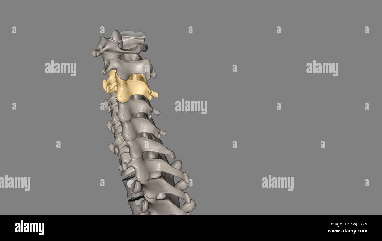 The C3 vertebra is a bone of the cervical spine found in the neck ...