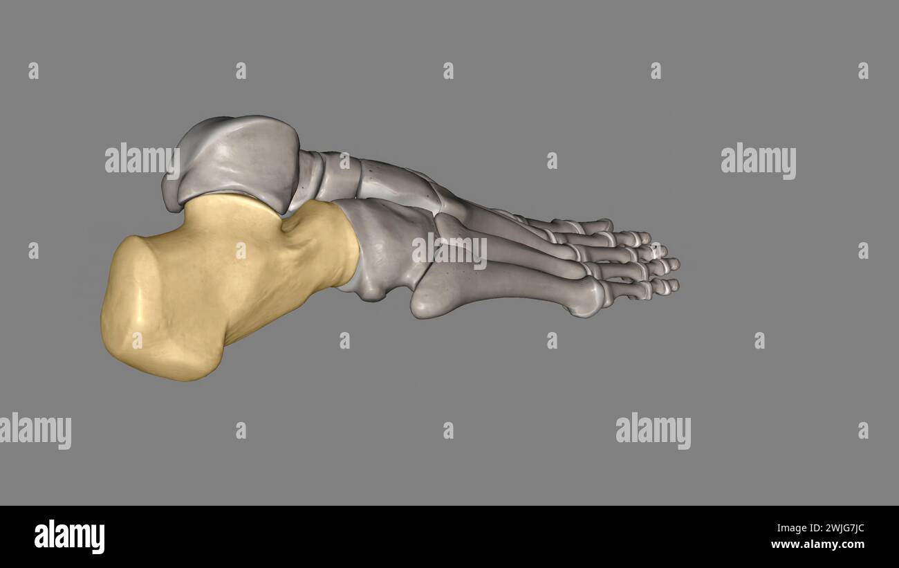 The calcaneus (heel bone) is the largest of the tarsal bones in the ...
