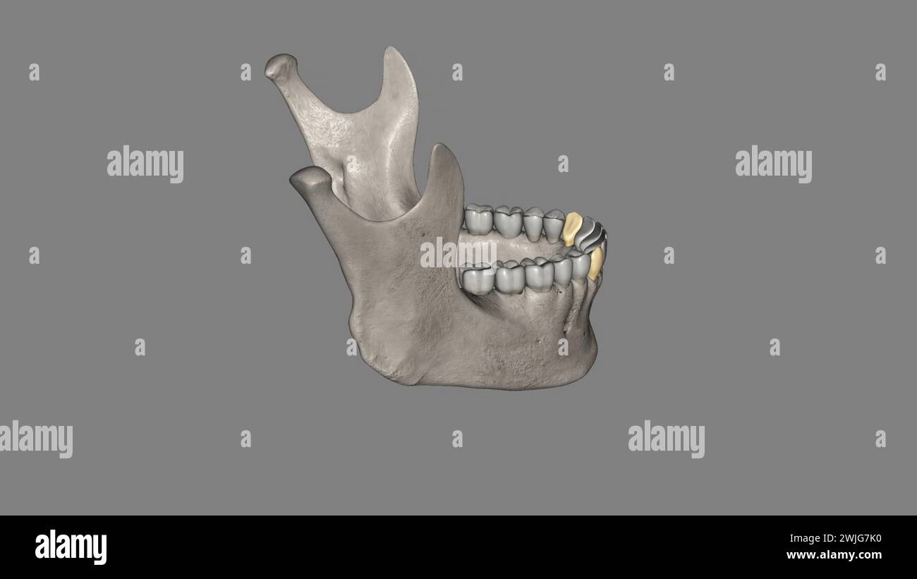 The mandibular canine is the tooth located distally from both ...