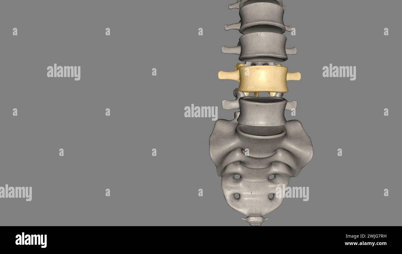 The L4 and L5 are the lowest vertebrae, or spinal bones, in the lumbar ...