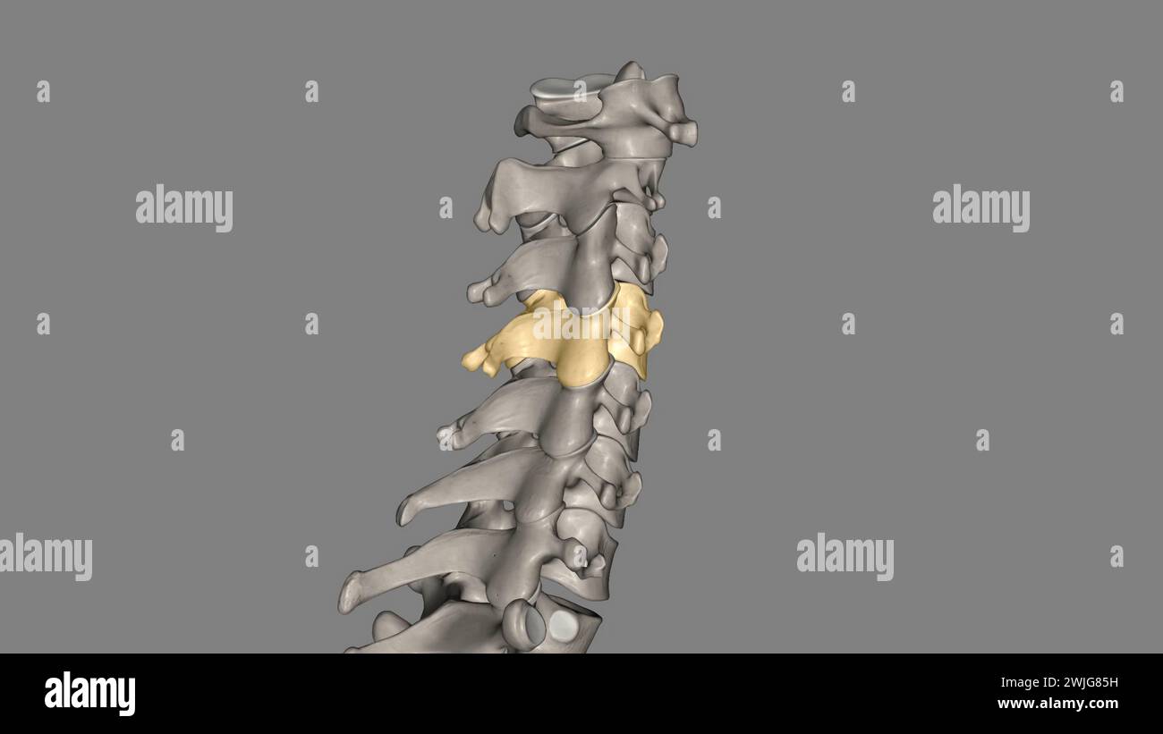 The fourth cervical vertebra (C4) is centrally located in the cervical ...
