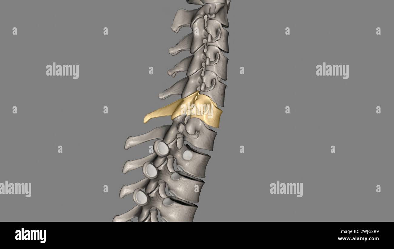 The C6 spinal vertebra is part of the cervical spinal cord, located in ...