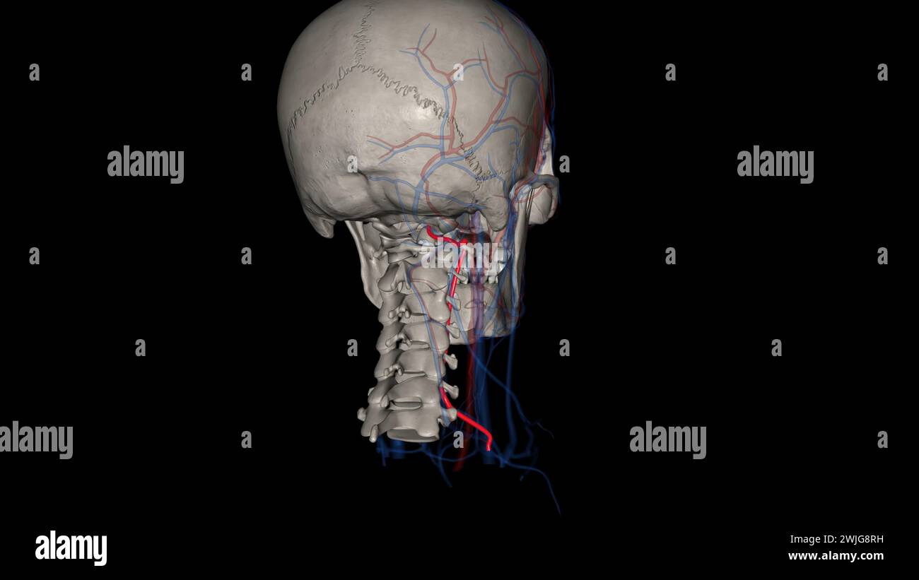 The vertebral arteries run through the spinal column in the neck to ...
