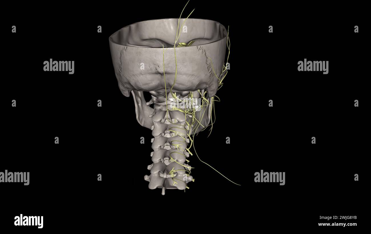 Head and neck pathology hi-res stock photography and images - Alamy