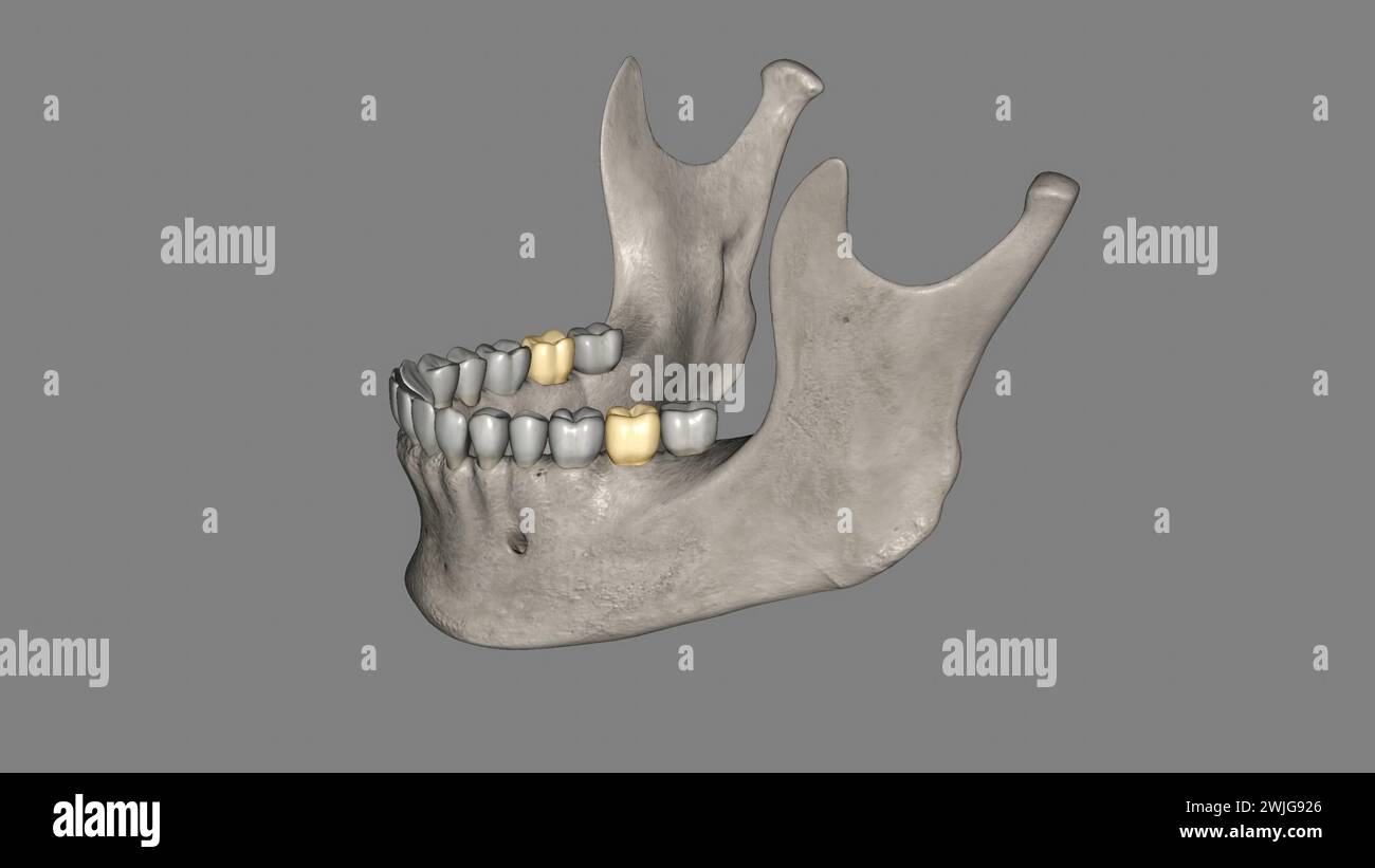 Mandibular first molar hi-res stock photography and images - Alamy