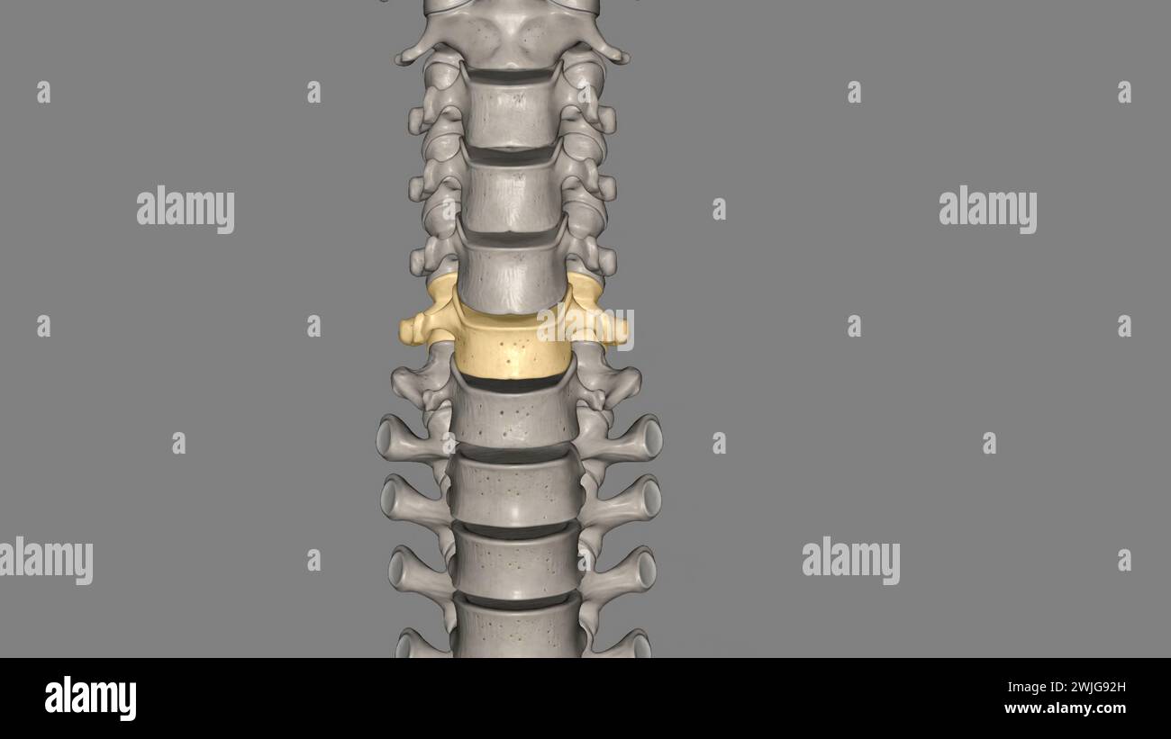 The C6 spinal vertebra is part of the cervical spinal cord, located in ...