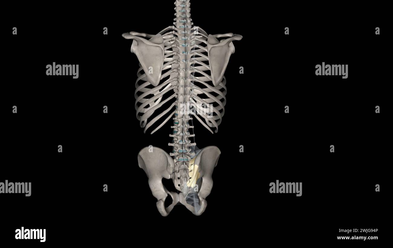 The posterior sacroiliac ligament is a compound ligament composed of ...