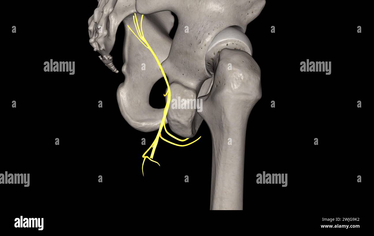 Posterior femoral cutaneous nerve hi-res stock photography and images ...