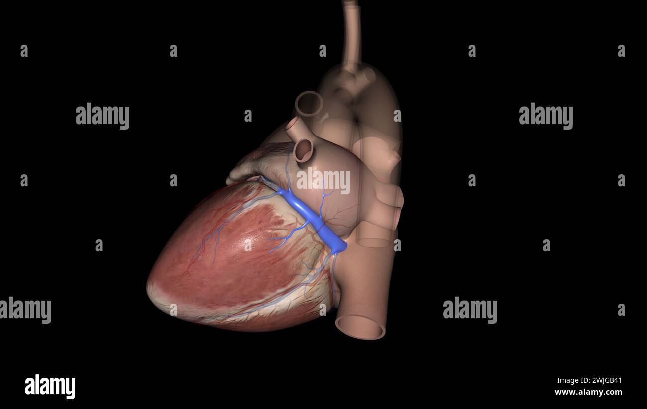Coronary sinus hi-res stock photography and images - Alamy