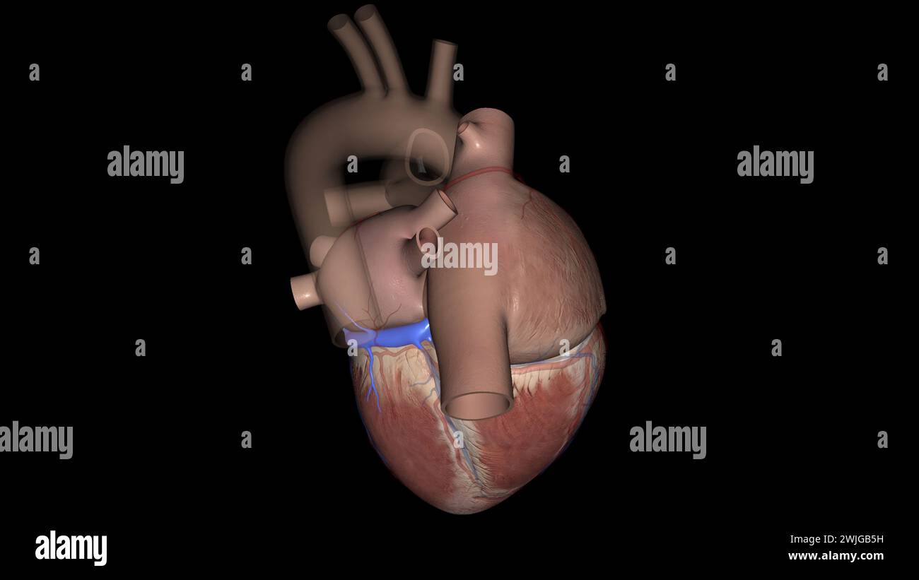 Coronary sinus hi-res stock photography and images - Alamy