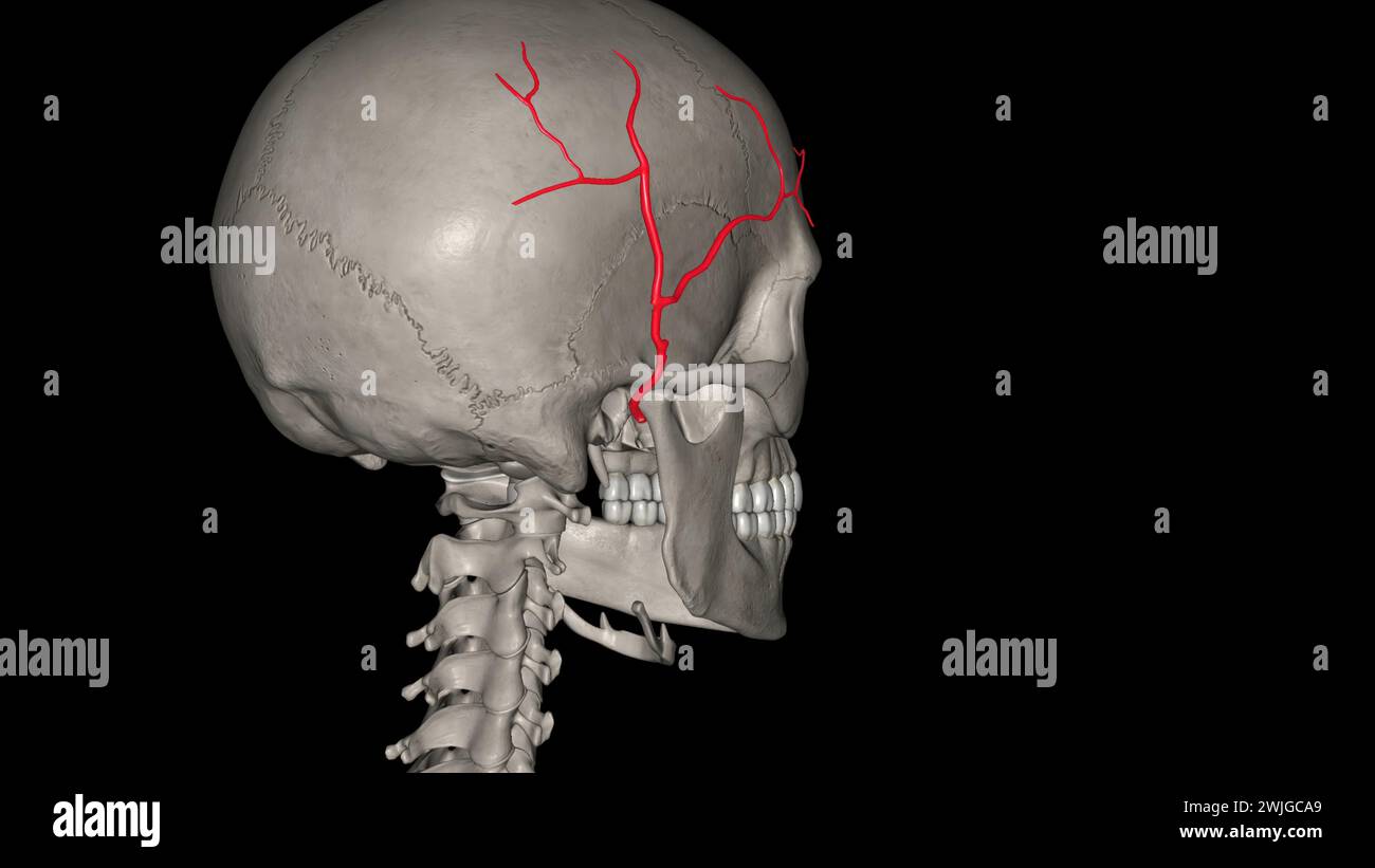 The superficial temporal artery is a terminal branch of your external ...