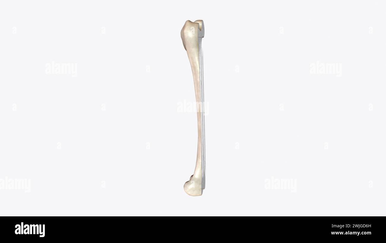 The periosteum is a membrane that covers the outer surface of all bones ...
