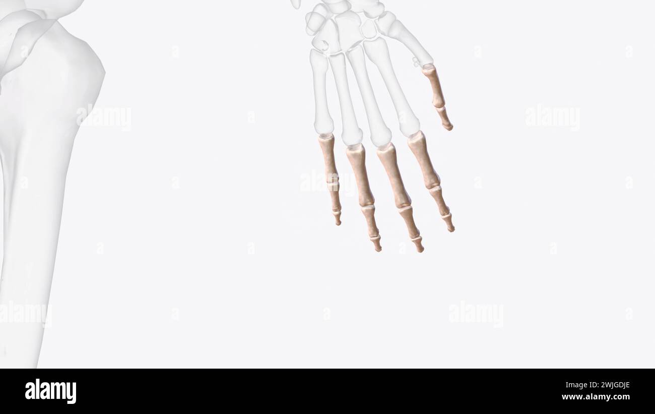 Medical illustration arthritis in hands hi-res stock photography and ...