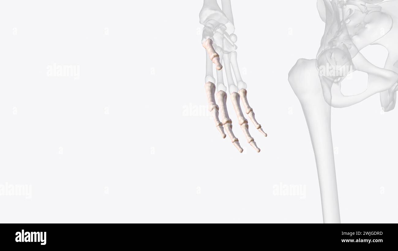 Medical illustration arthritis in hands hi-res stock photography and ...