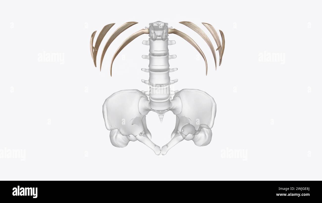 Transverse femur fracture hi-res stock photography and images - Alamy