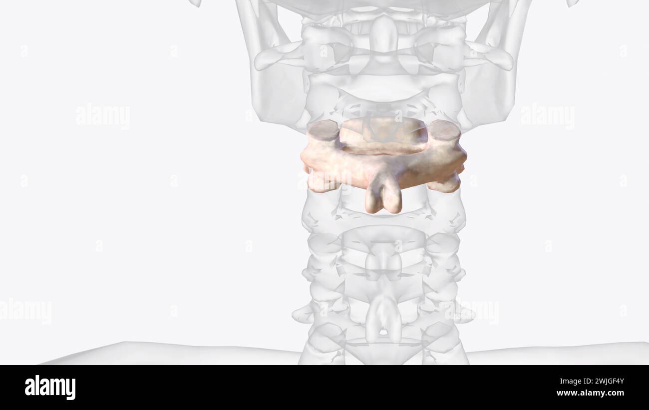 Fracture of spinous process of cervical spine hi-res stock photography ...