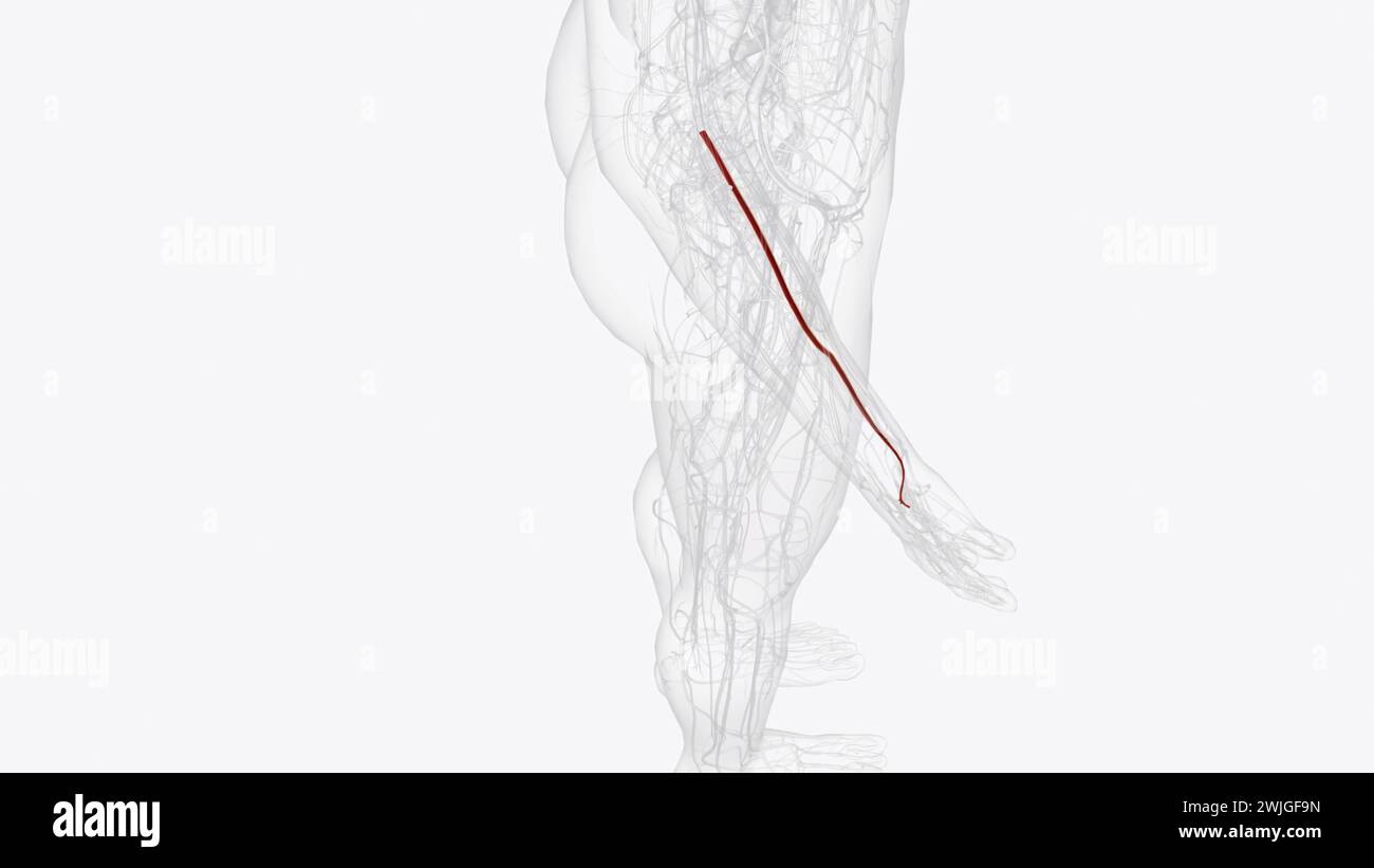 Stent arm hi-res stock photography and images - Alamy