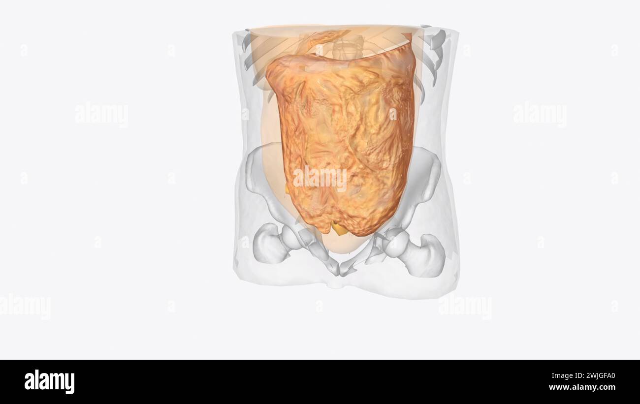 The abdominal viscera can be divided anatomically by their relationship ...