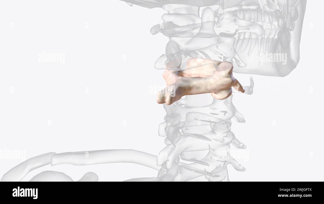Fracture of spinous process of cervical spine hi-res stock photography ...