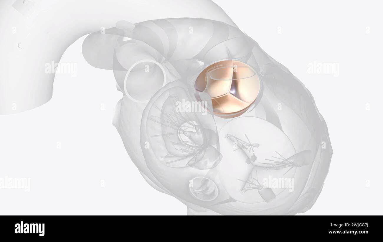 he aortic valve is one of four heart valves and is the final one ...