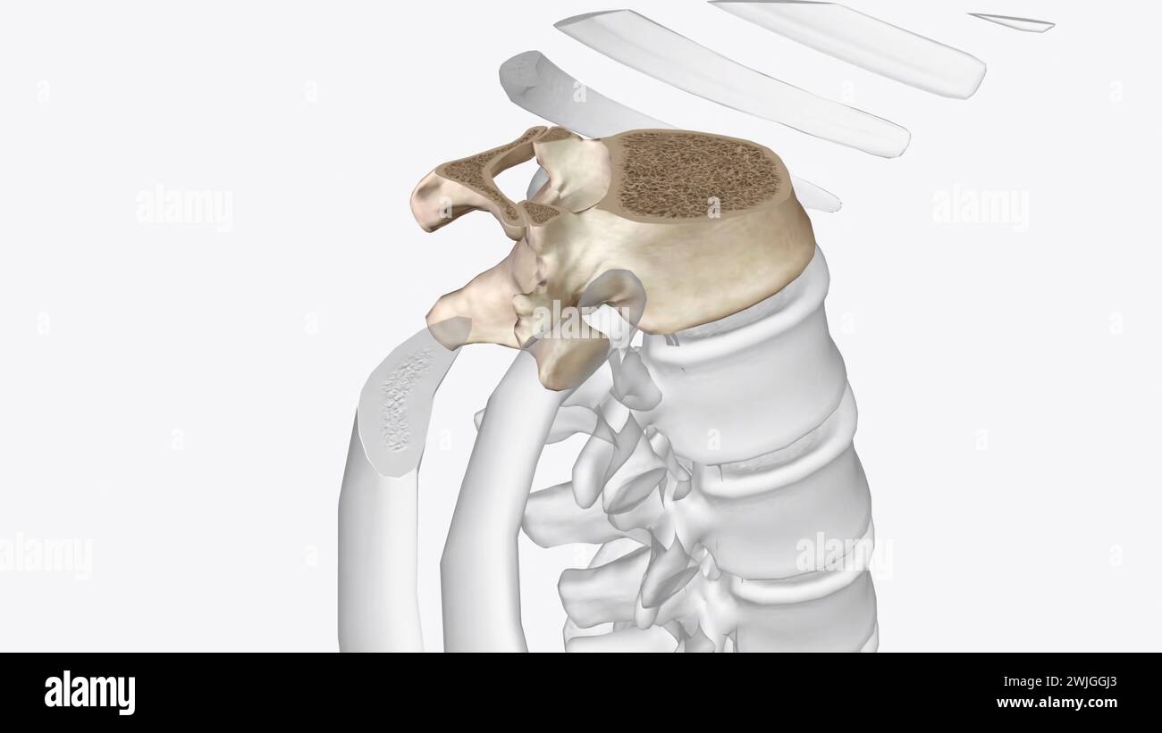 Transverse femur fracture hi-res stock photography and images - Alamy