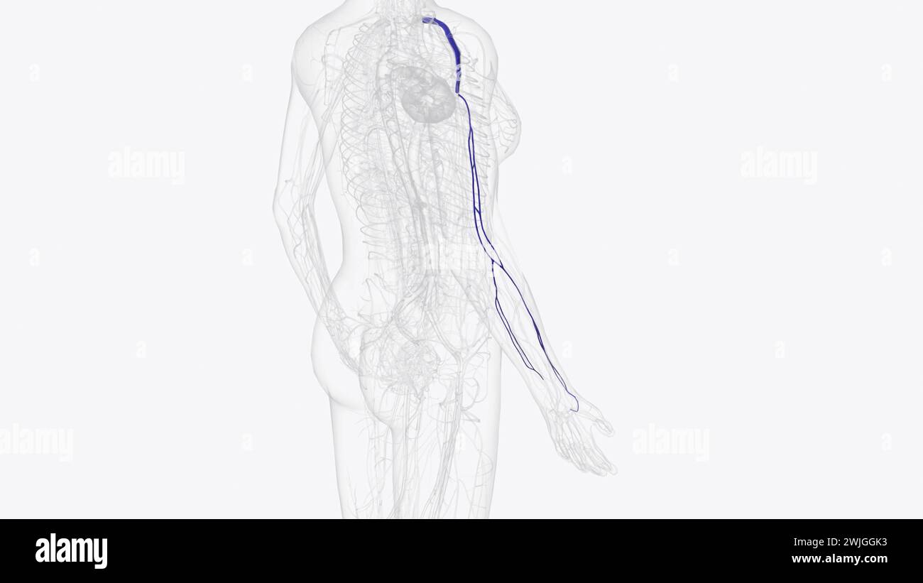 Stent arm hi-res stock photography and images - Alamy