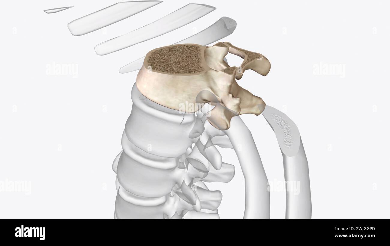 Transverse femur fracture hi-res stock photography and images - Alamy