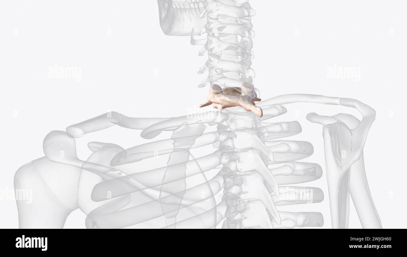 Vertebra prominens is the name of the seventh cervical vertebra 3d ...