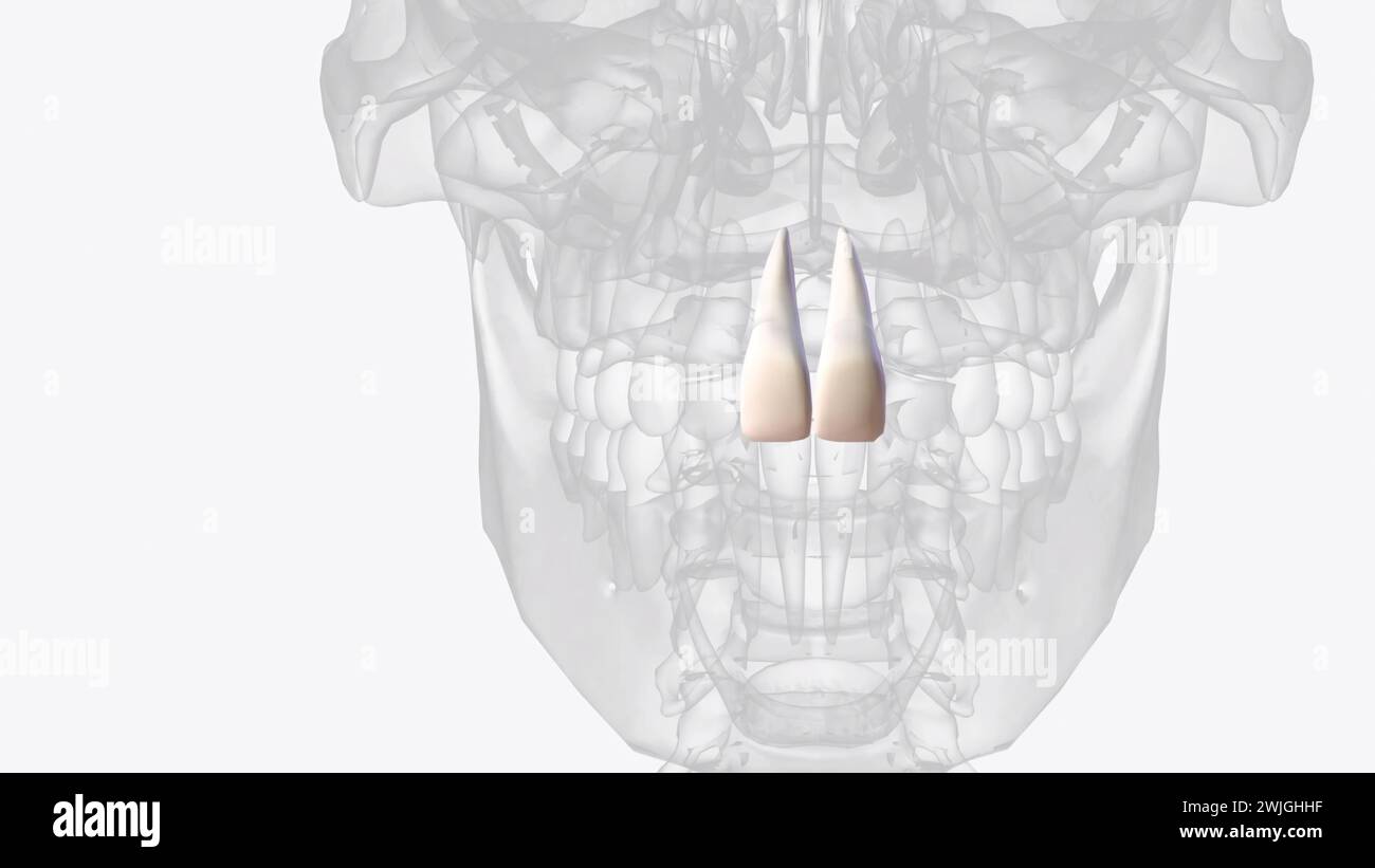 Maxillary fracture hi-res stock photography and images - Alamy