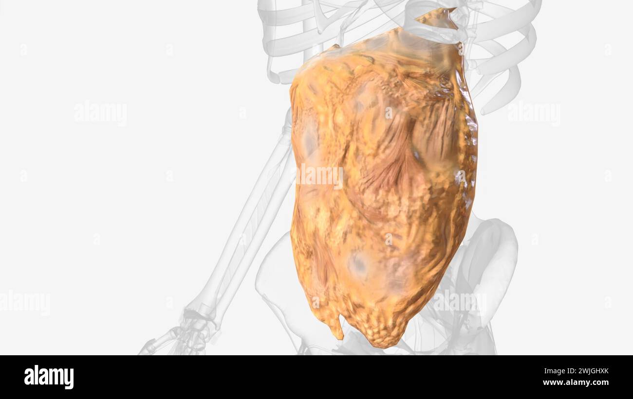 The greater omentum is a two-leaflet hammock of fibro-fatty tissue that ...