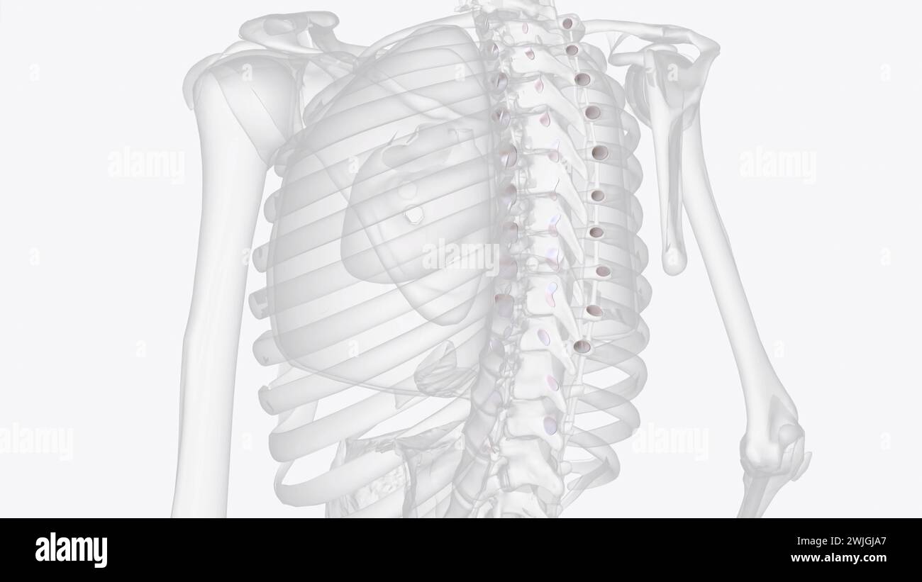 Fracture of the proximal humerus hi-res stock photography and images ...