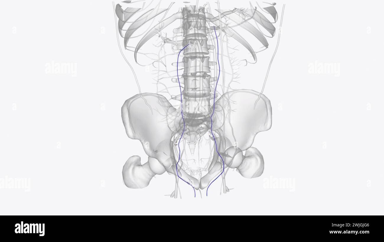 Carotid blood clot Cut Out Stock Images & Pictures - Alamy