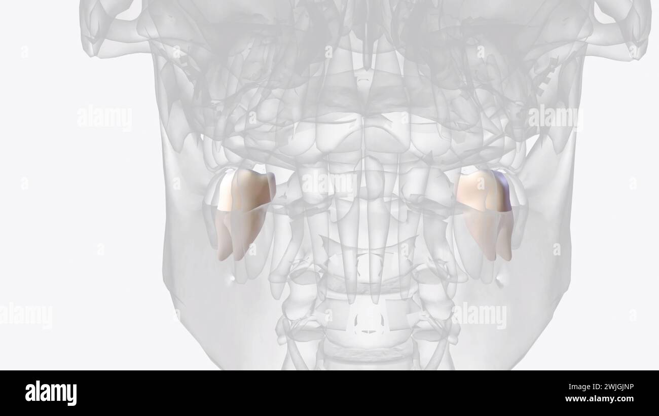 The mandibular first molar usually has two roots, a mesial and a distal ...