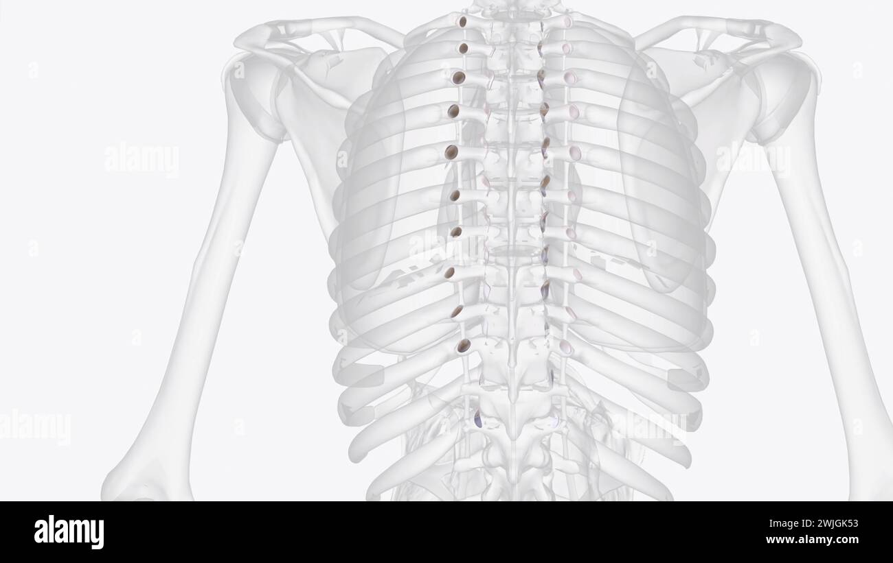Fracture of the proximal humerus hi-res stock photography and images ...