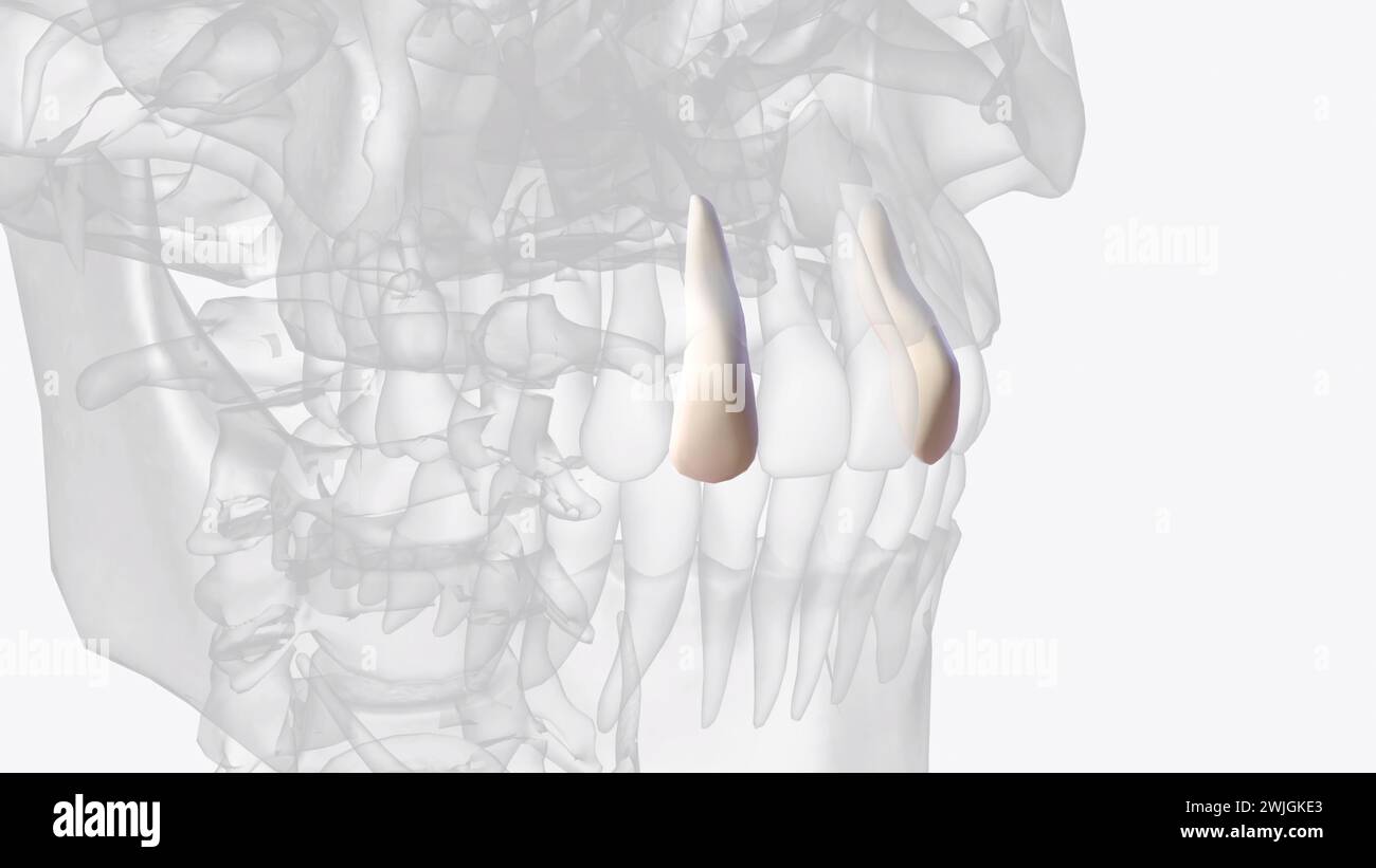 The maxillary lateral incisors are a pair of upper (maxillary) teeth ...