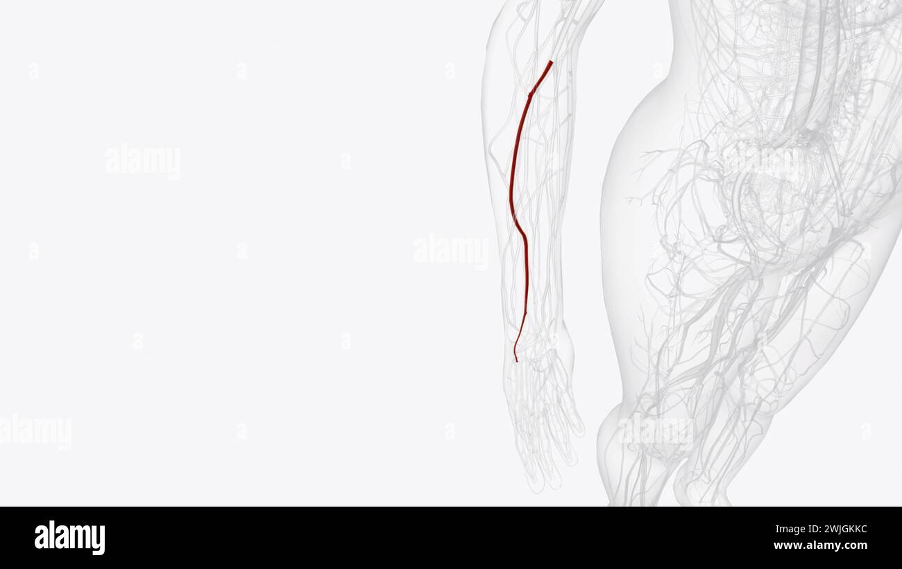 Stent arm hi-res stock photography and images - Alamy