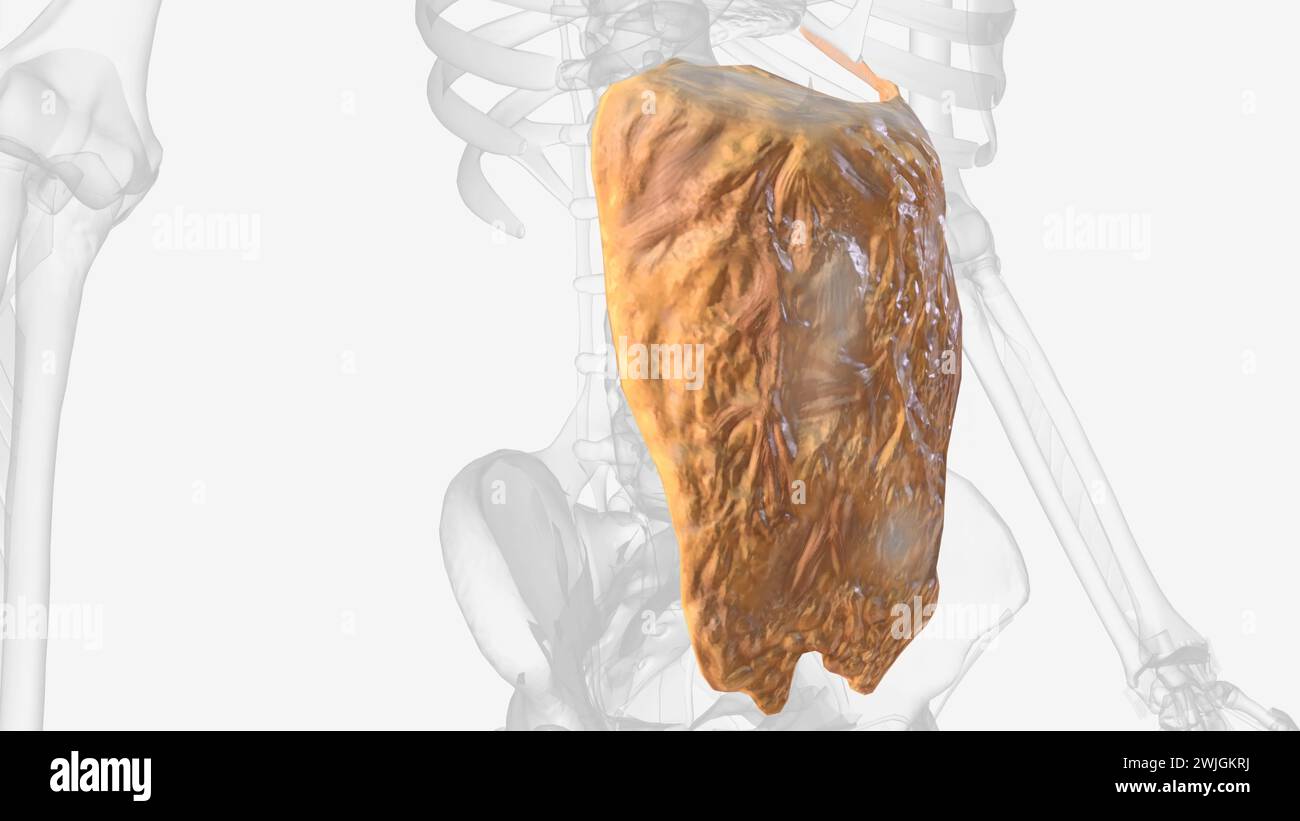 The greater omentum is a two-leaflet hammock of fibro-fatty tissue that ...