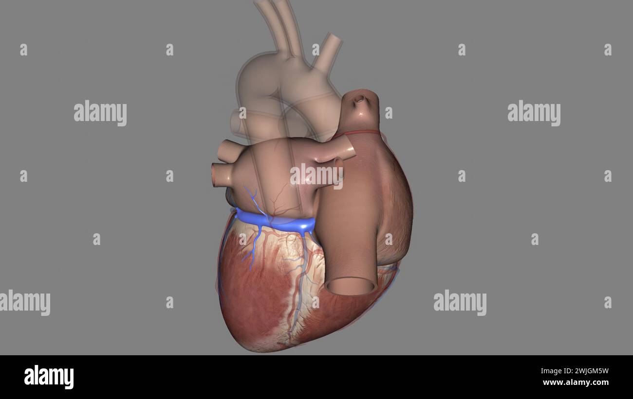 Coronary sinus hi-res stock photography and images - Alamy