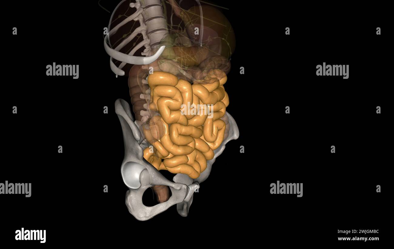 Small intestine tumor illustration hi-res stock photography and images ...