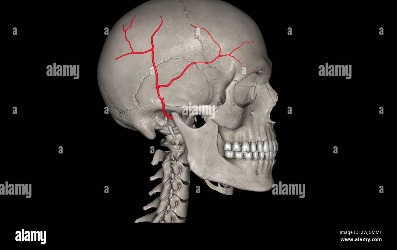 The superficial temporal artery is a terminal branch of your external ...