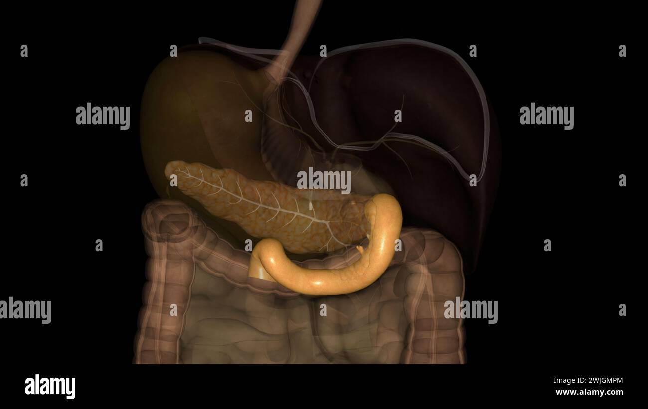 Small intestine tumor illustration hi-res stock photography and images ...