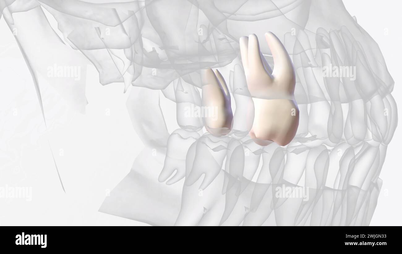 Maxillary fracture hi-res stock photography and images - Alamy