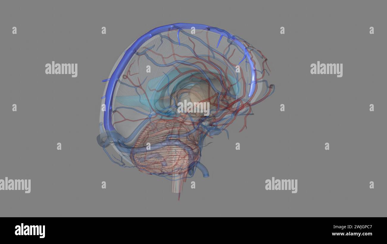 The superior sagittal sinus is the major component of the superficial ...