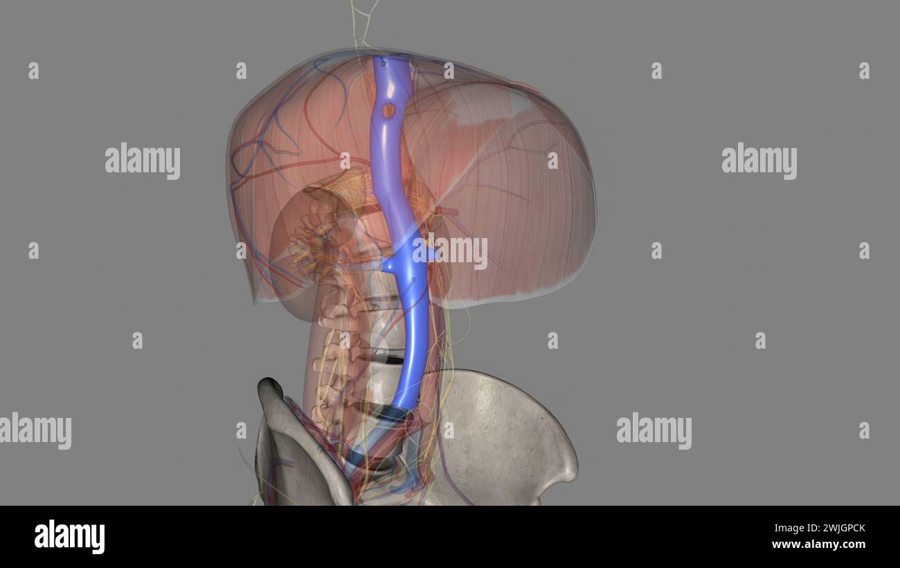 The inferior vena cava (IVC) is a large retroperitoneal vessel formed ...
