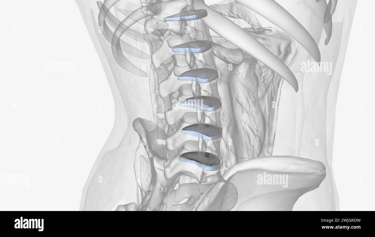 The intervertebral disc (IVD) is important in the normal functioning of ...