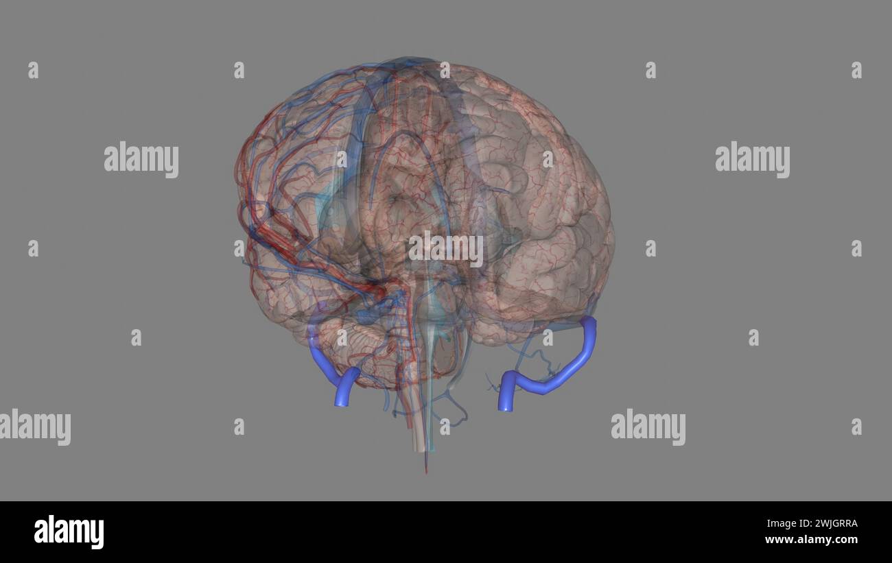 The sigmoid sinus is a paired intracranial venous channel 3d ...