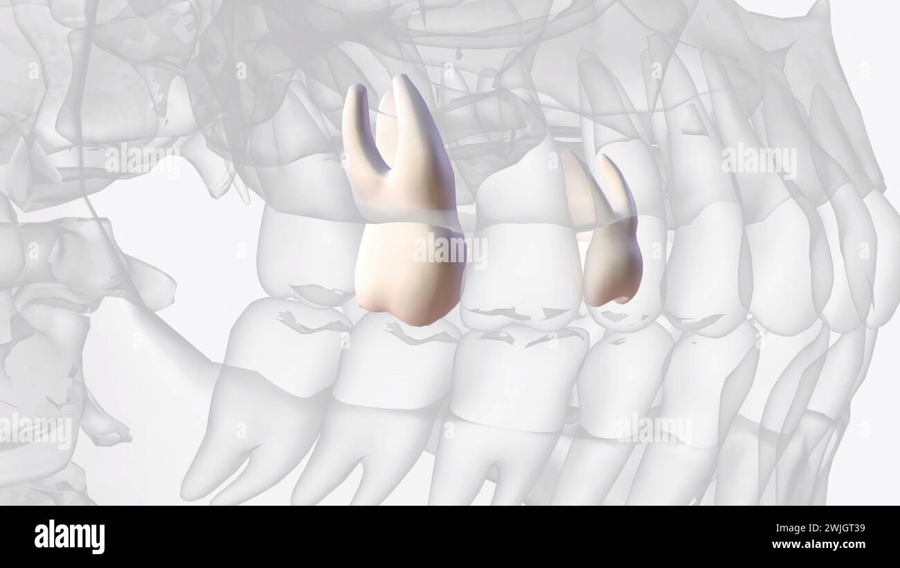 Maxillary fracture hi-res stock photography and images - Alamy