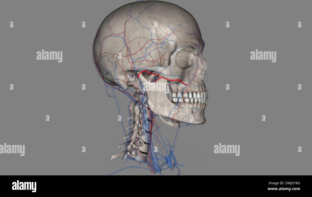 The transverse facial artery (TFA) is a branch of the superficial ...