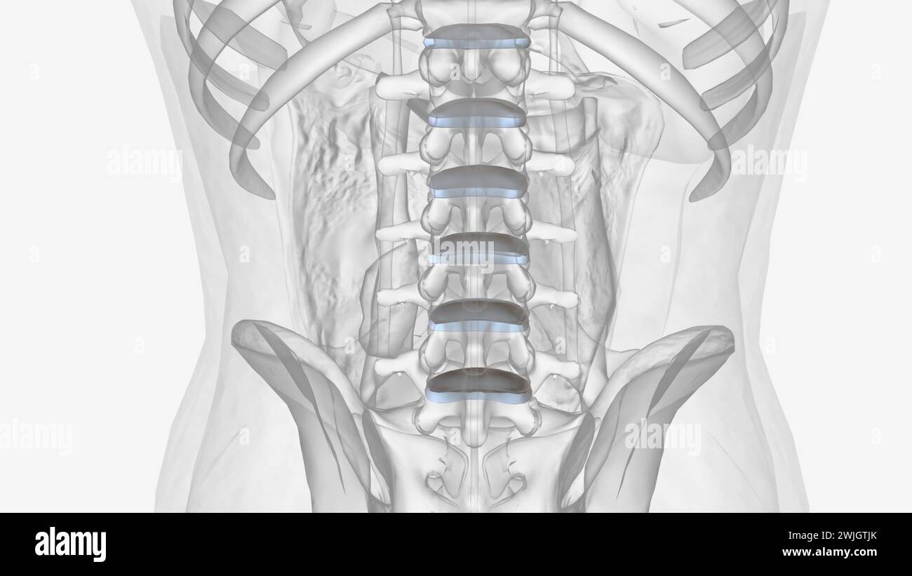 The intervertebral disc (IVD) is important in the normal functioning of ...